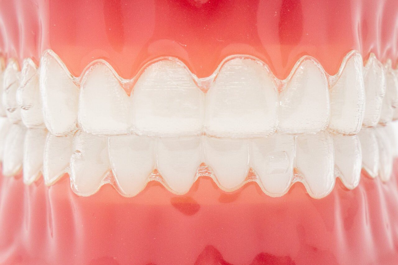 Adult Treatment | Braces, Invisalign | Simister Orthodontics